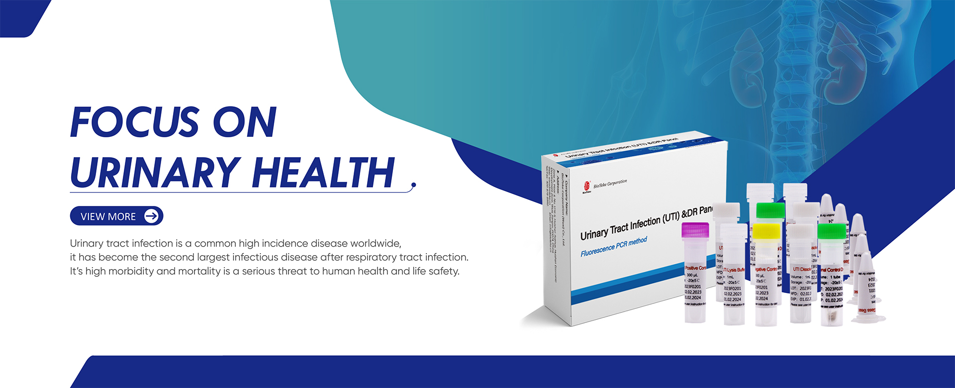 Rapid Test, Rapid Extraction, Covid 19 Test Manufacturer & Supplier ...